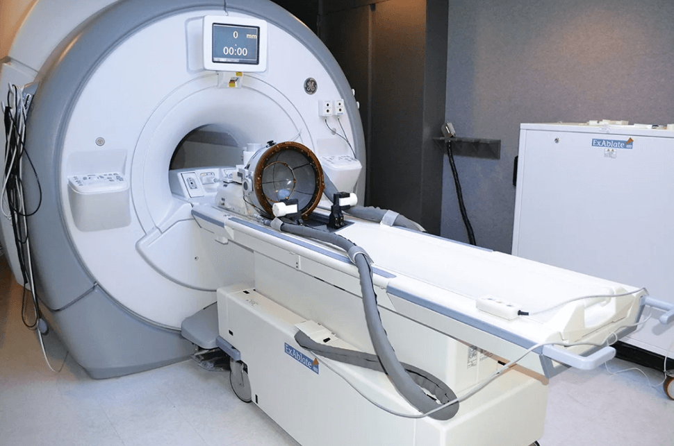 Exploring the Power of High Intensity Focused Ultrasound