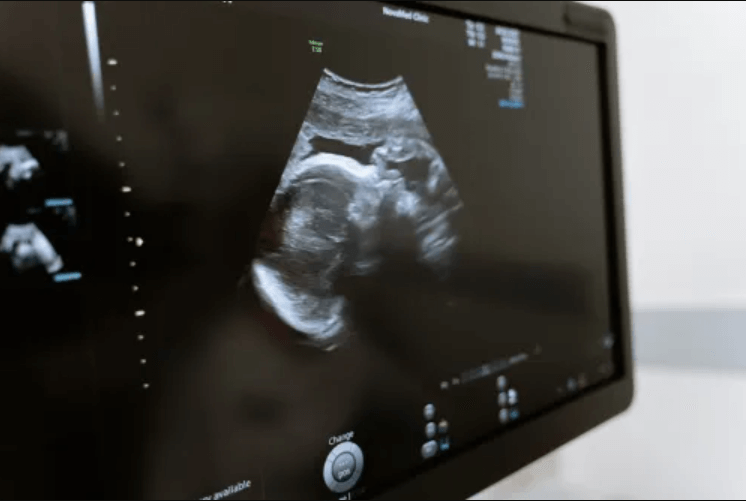 5 Months Pregnant Ultrasound: Glimpse into Your Baby's Development